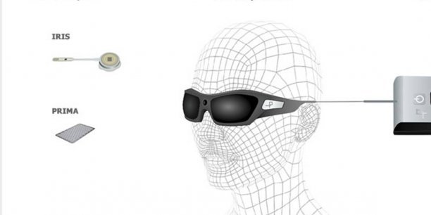 PRIMA BIONIC VISION SYSTEM - Miniaturized Wireless Photovoltaic ...