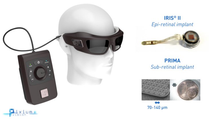 PRIMA BIONIC VISION SYSTEM - Miniaturized Wireless Photovoltaic ...