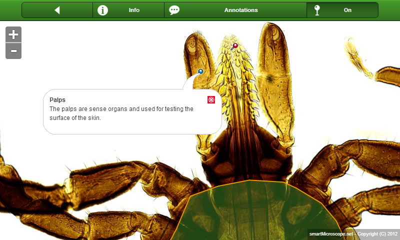Smart Microscope Lite - first virtual mobile microscope app | Steemhunt