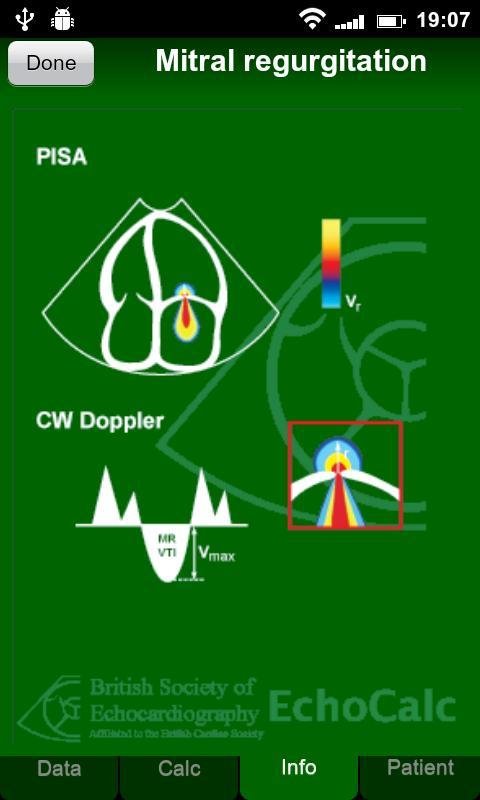 EchoCalc - Echocardiography calculators commonly used in practice ...