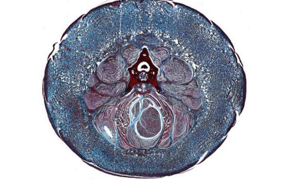 Calabaria Reinhardtii: The Unsightly Snake with Rhinoceros Skin