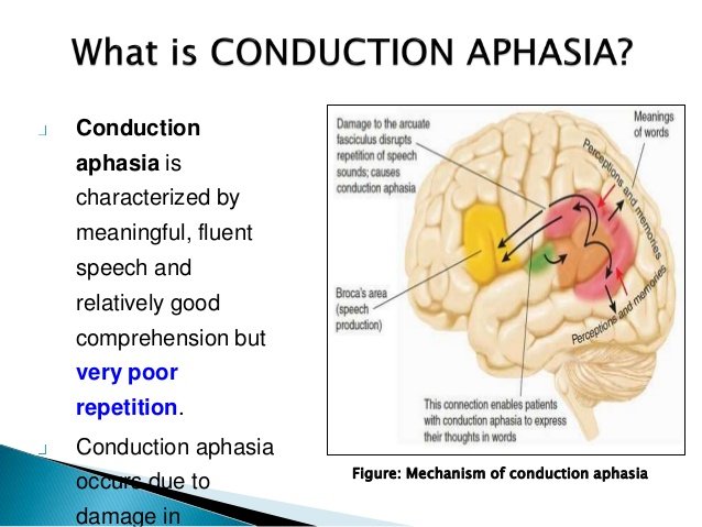 APHASIA, WHAT WE NEED TO KNOW ABOUT THIS DISORDER!!!