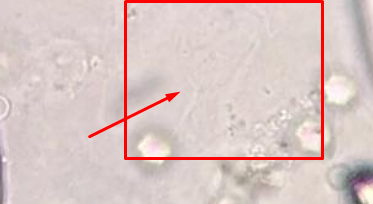 Mundo microscópico-Análisis de un examen de orina (Uroanálisis).