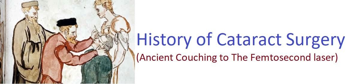 A Brief history of Cataract Surgery : From Ancient couching method to ...