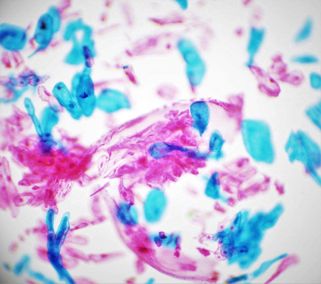 Pepper under the microscope. — Steemit