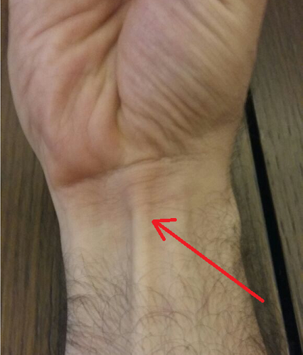 Daily Mysteries #3: Are you Missing a Muscle?