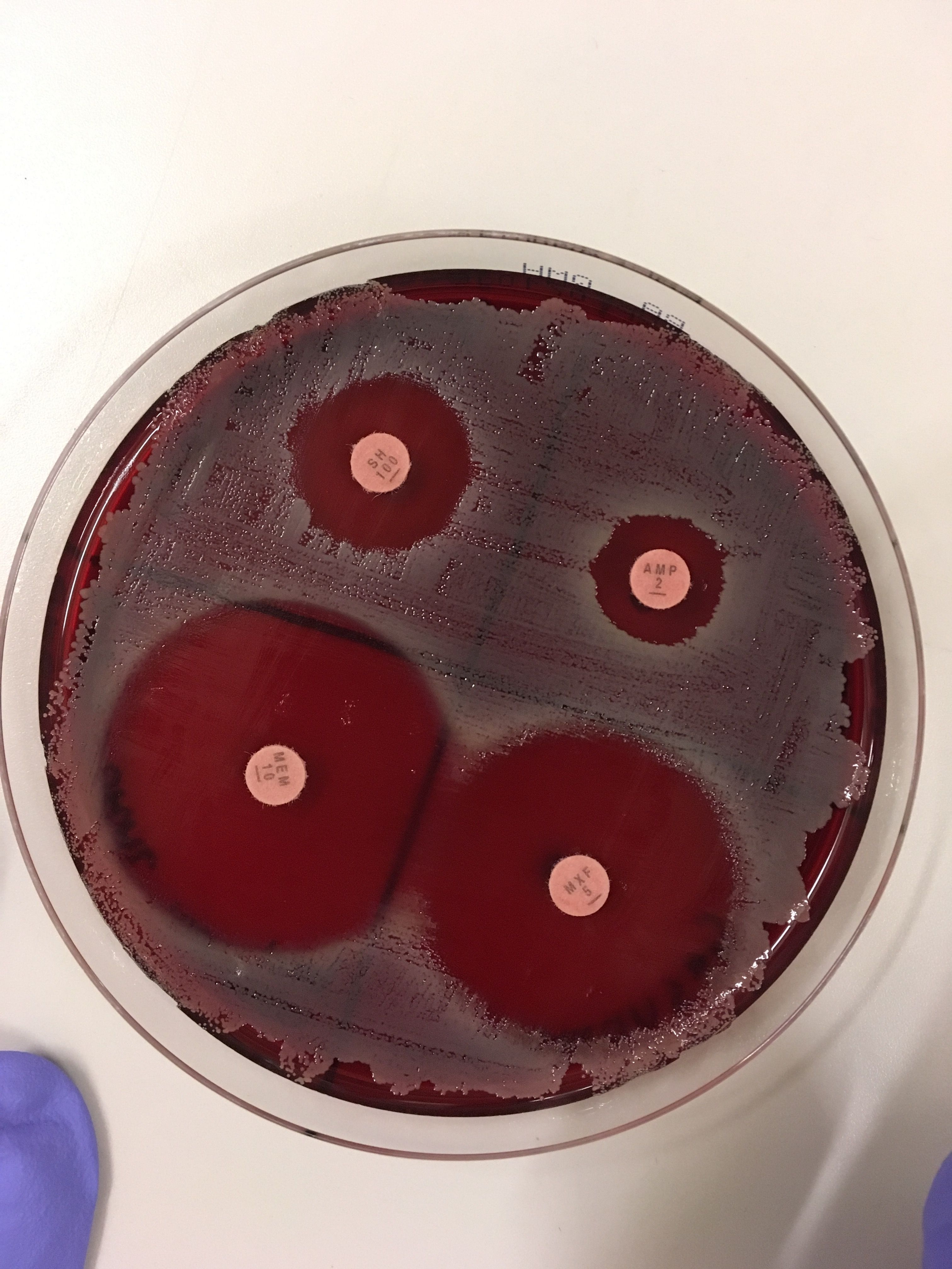 Figure Antimicrobial Susceptibility Of Streptococcus Spp, 51% OFF