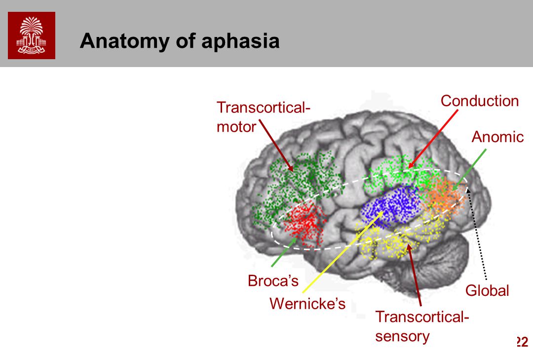 APHASIA WHAT WE NEED TO KNOW ABOUT THIS DISORDER 