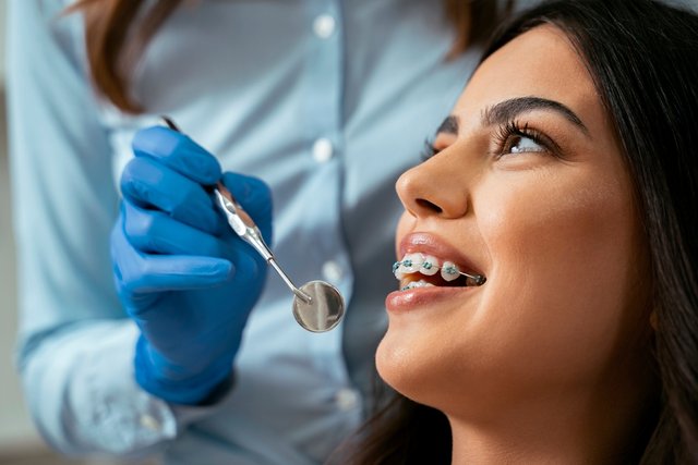How Adult Braces Can Improve Your Smile and Oral Health in Miami — Steemit